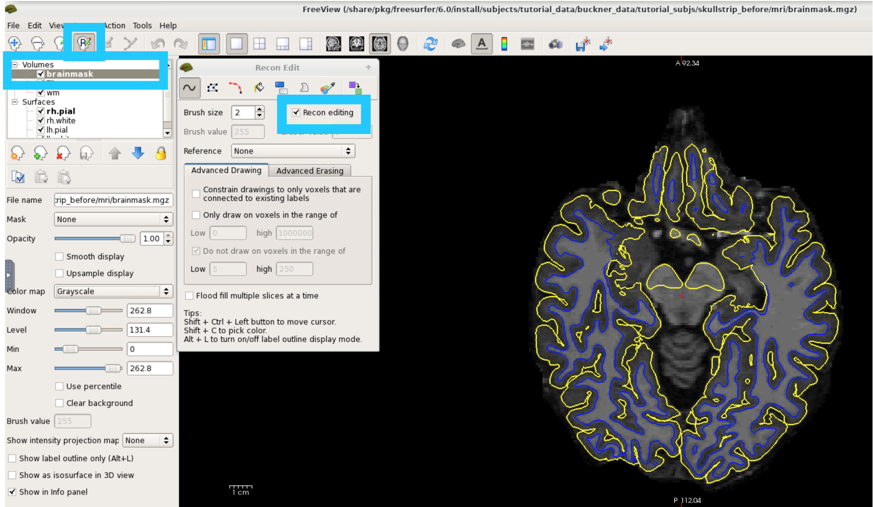 Index of /examples/imaging/freesurfer